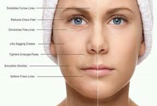 Microchannelling Information | Skin 'n Tonic